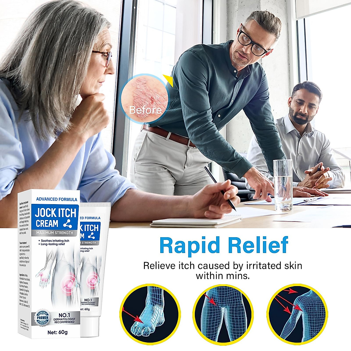 iTecFreely Jock Itch Cream, Powerful & Fast Jock Itch Cream, Jock Itch Care Extra Strength for Men & Women, Tinea Corporis, Itch Cream- 60g