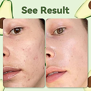 ANAI RUI Green Tea Face Mask with Avocado, Clay Facial Mask for Acne, Detox, Face Cleansing Mask, Hydrating, Nourishing, Soothing, 120g/4.23 oz