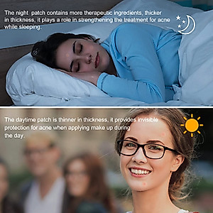 AVJONE Day and Night Hydrocolloid Acne Pimple Patch for Covering Zits and Blemishes, Spot Stickers for Face and Skin, Vegan - friendly and Not Tested on Animals (108+36 Patches)