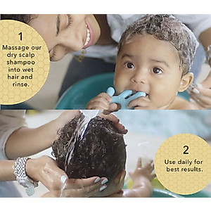 BELLA B Cradle Cap Shampoo & Cradle Cap Scalp Treatment And Conditioner - Baby Shampoo And Conditioner - Cradle Cap Shampoo For Babies - Kid Shampoo - Dry Scalp Shampoo And Conditioner For Dry Scalp