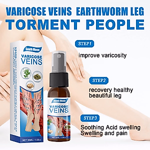 OUKPANE 2pcs Veinhealing Varicose Veins Treatment Spray, Veinhealing Varicose Veins Spray, Vein Healing Varicose Veins Treatment Spray for Legs, Varicose Veins Miracle Spray (30ml)