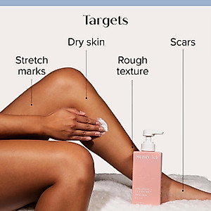 MEDIX Retinol Body Lotion + Hyaluronic Acid Cream Body Moisturizer Skincare Set | Hydrating + Firming Body Lotion For Improving The Look Of Stretch Marks, Sagging, & Crepey Skin, 2pc Set