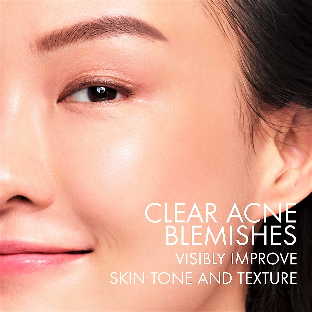 Vichy Normaderm Acne Control Daily Moisturizer, Acne Moisturizer For Face, 2% Salicylic Acid + Hyaluronic Acid + Vitamin C, Acne Treatment For Blackheads, Acne Blemishes & Enlarged Pores, Oil Free