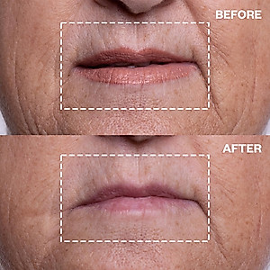 Wrinkles Schminkles Mouth & Lip Wrinkle Patch - Reusable Silicone Smoothing Pads for Noticeable Wrinkle Reduction - Lip Wrinkle Prevention for Youthful, Smooth Skin (2 Pack)