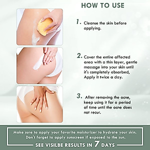 Butt Acne Clearing Treatment, Bum Acne Treatment Butt Pimple Cream Clears Pimples For the Buttocks, Back and Thigh Areas with Salicylic Acid, Pure Natural Ingredients and Fast Results