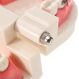 Angzhili 1 Piece Dental Demonstration Orthodontic Model with Metal Wires and Bracket (Metal bracket)
