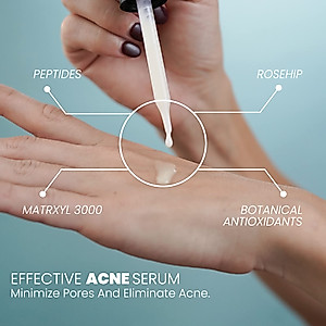 Eva Naturals Skin Firming Serum with Niacinamide and Hyaluronic Acid, 1 oz