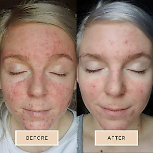 Averr Aglow Luminous Complexion Toner, Face Skincare, Reduce Blackheads Breakouts & Dark Circles, Natural Solution Moisturizing Facial Toner, Hydrating & Soothing Effect