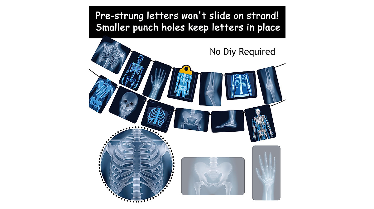 Radiology X Ray Birthday Party Decorations for Themed Parties