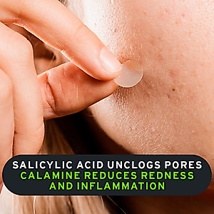 No BS Intensive Overnight Pimple Patches - Fast-Acting Acne Spot Treatment for Clear, Healthy Skin -Hydrocolloid, Salicylic Acid, Calamine (1 BOX of 36ct). Includes Free Skincare Samples