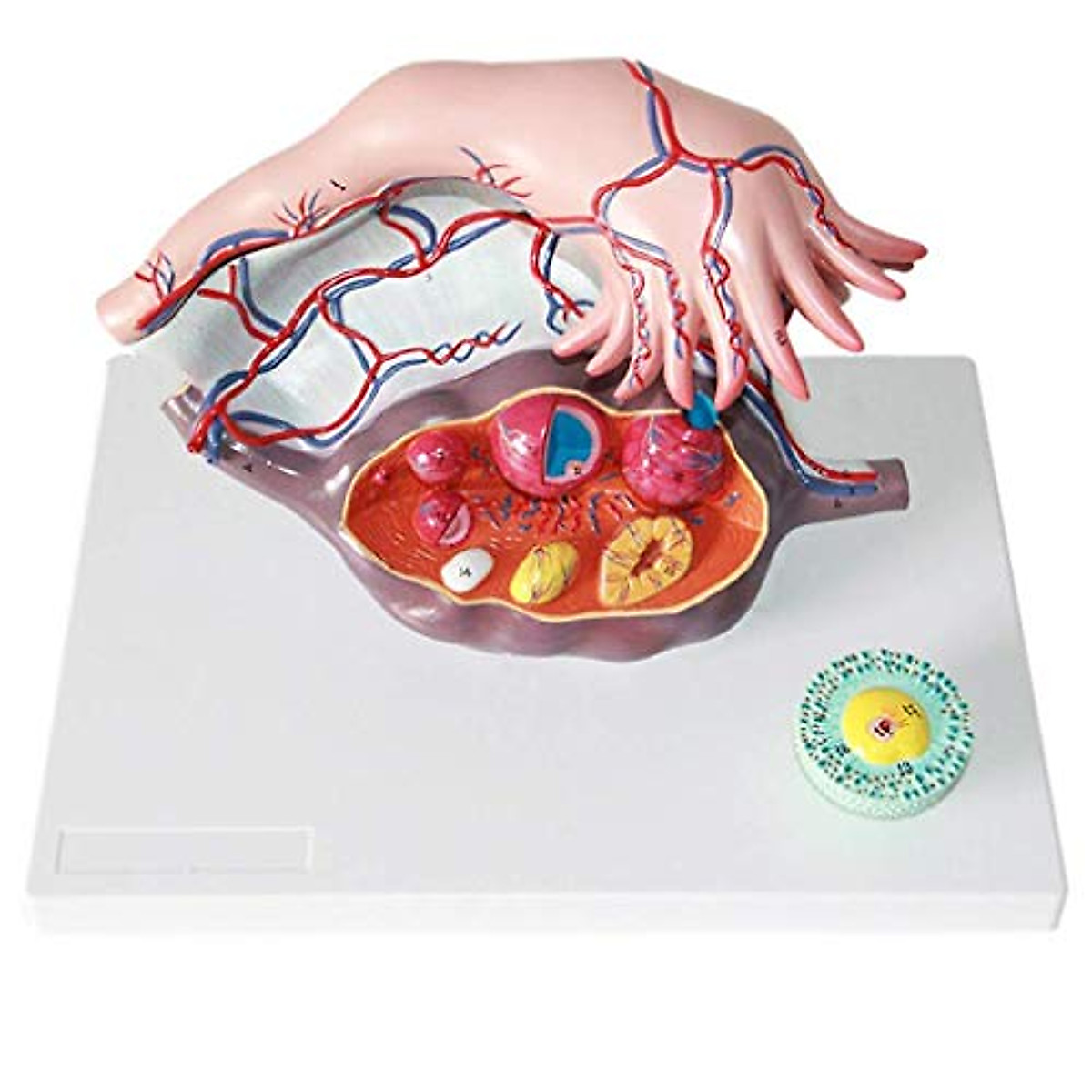 DEAVER Uterine Anatomy Model Ovarian Enlargement Model Skin and Genitourinary System Anatomical Medical Educational Training Aid,Medical Models & Educational Materials
