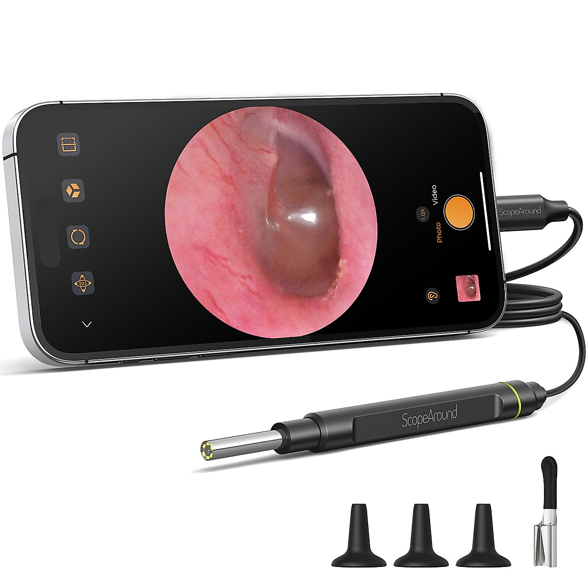 ScopeAround Otoscope Ear Camera, Ear Wax Removal Tool 1080p FHD Video Otoscope, 3.9mm Ear Wax Removal Camera with 6 LED Lights Visual Ear Scope, Compatible with iPhone15 & Android