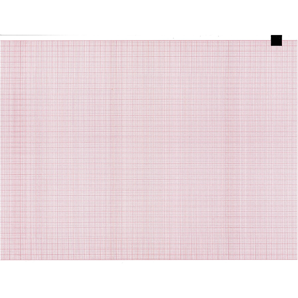 Edan EDAN SE-12 Paper (215mm X 280mm X 100 Sheets) 3 Packs Per Box(for Newer Edan Machines) Please See The Q- Mark Location