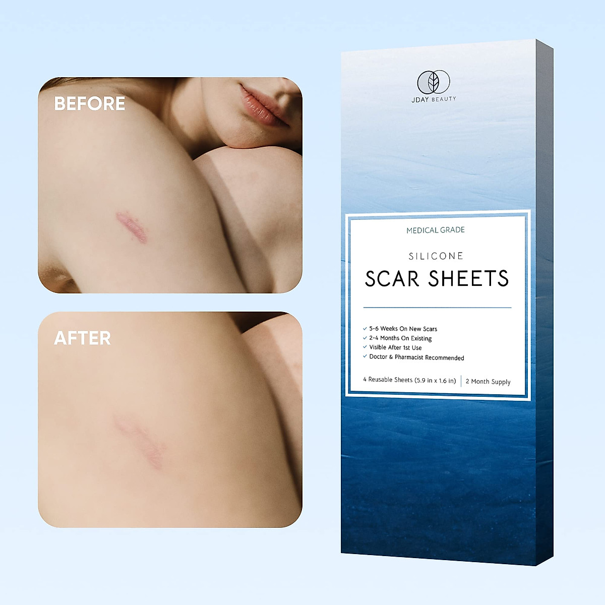 Silicone Scar Removal Sheets - Breathable Reusable & Waterproof Keloid Scar Removal Patches Caused by C-Section, Surgery, Burn, Acne, Stretch Marks Healing Alternative to Gel, Tape & Cream (4 sheets)