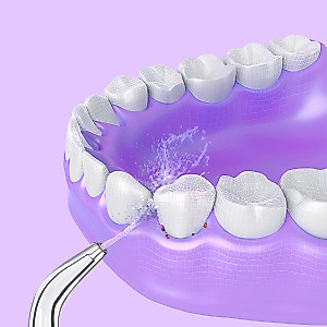 2PCS Replacement Tips Oral Hygiene Accessories Water Jet Standard Sprinkler for Waterpik Dental Water Oral Irrigator Wp-100 Wp-450 Wp-250 Wp-300 Wp-660 Wp-900 by WyFun