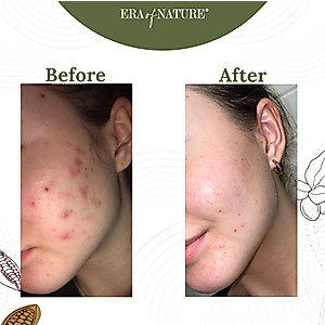 era of nature Best Raw ORGANIC AFRICAN BLACK SOAP, for Dry Skin and Skin Conditions. Pure & Natural Ingredients, Imported From Ghana - 1lb (16oz)