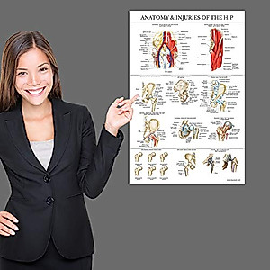 Palace Learning Laminated Anatomy and Injuries of the Hip Poster - Hip Joint Anatomical Chart - 18" x 24"