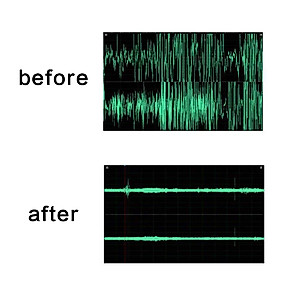 Lavalier Wind Muff 2 Pack Lapel Microphone Wind Muff 0.2/0.4 Inch Furry Lav Windscreen Windproof Wind Screen (0.4inch, Black/White)