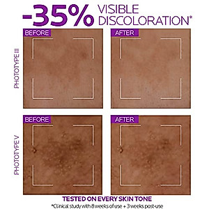 La Roche Posay Niacinamide 10 Face Serum, Brightening and Anti-Aging Facial Serum with 10% Niacinamide, Reduces the Look of Dark Spots, Discoloration, and Uneven Skin Tone