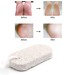 ZHome Natural Pumice Stone for Feet, Phogary Lava Pedicure Tools Hard Skin Callus Remover for Feet and Hands 2PCS