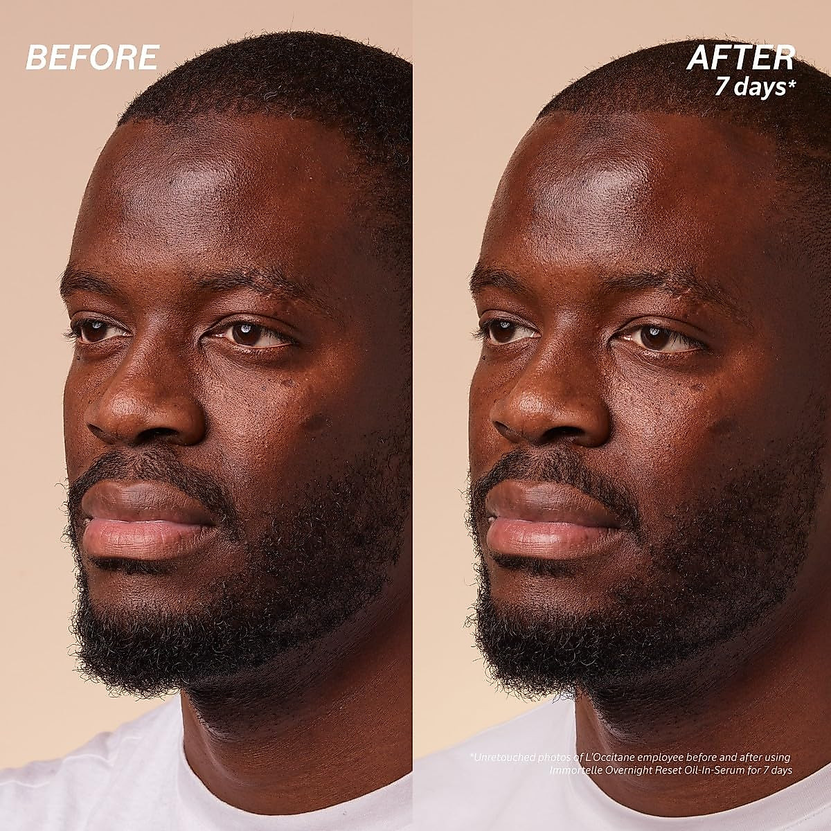 L'OCCITANE Immortelle Overnight Reset Oil-In-Serum: More Radiant Skin In 1 Night, Smooth Fine Lines, Revitalize Dull Skin, Award-Winner, With Immortelle Essential Oil, 1.6 Fl. Oz