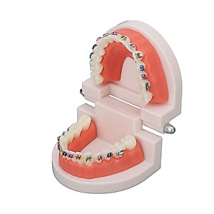 Typodonts Orthodontics Demonstration Model, Dental Orthodontic Model with Metal Wires and Bracket Teaching for Adults and Children Learning