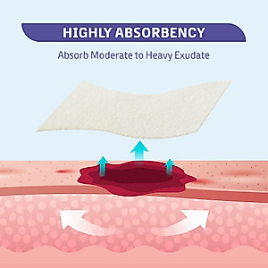 Conkote Calcium Alginate Wound Dressing Pads, 4” x 4” Pad Size, 10 Pack, Non-Stick Padding, Sterile, Highly Absorbent & Comfortable