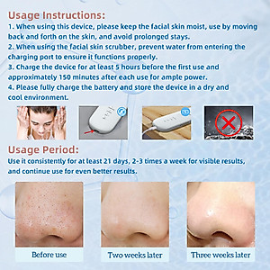 GUGUG Skin Scrubber Face Spatula Skin Spatula Pore Cleaner Blackhead Remover Tools for Facial Deep Cleansing-4 Modes -White