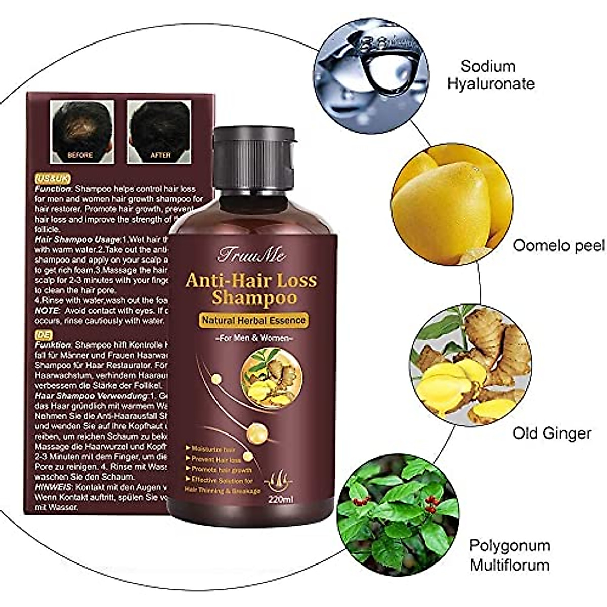 TruuMe Hair Growth Shampoo, Anti Hair Loss Shampoo, Helps Stop Hair Loss, Regrowth Shampoo for Men & Women, 220mL