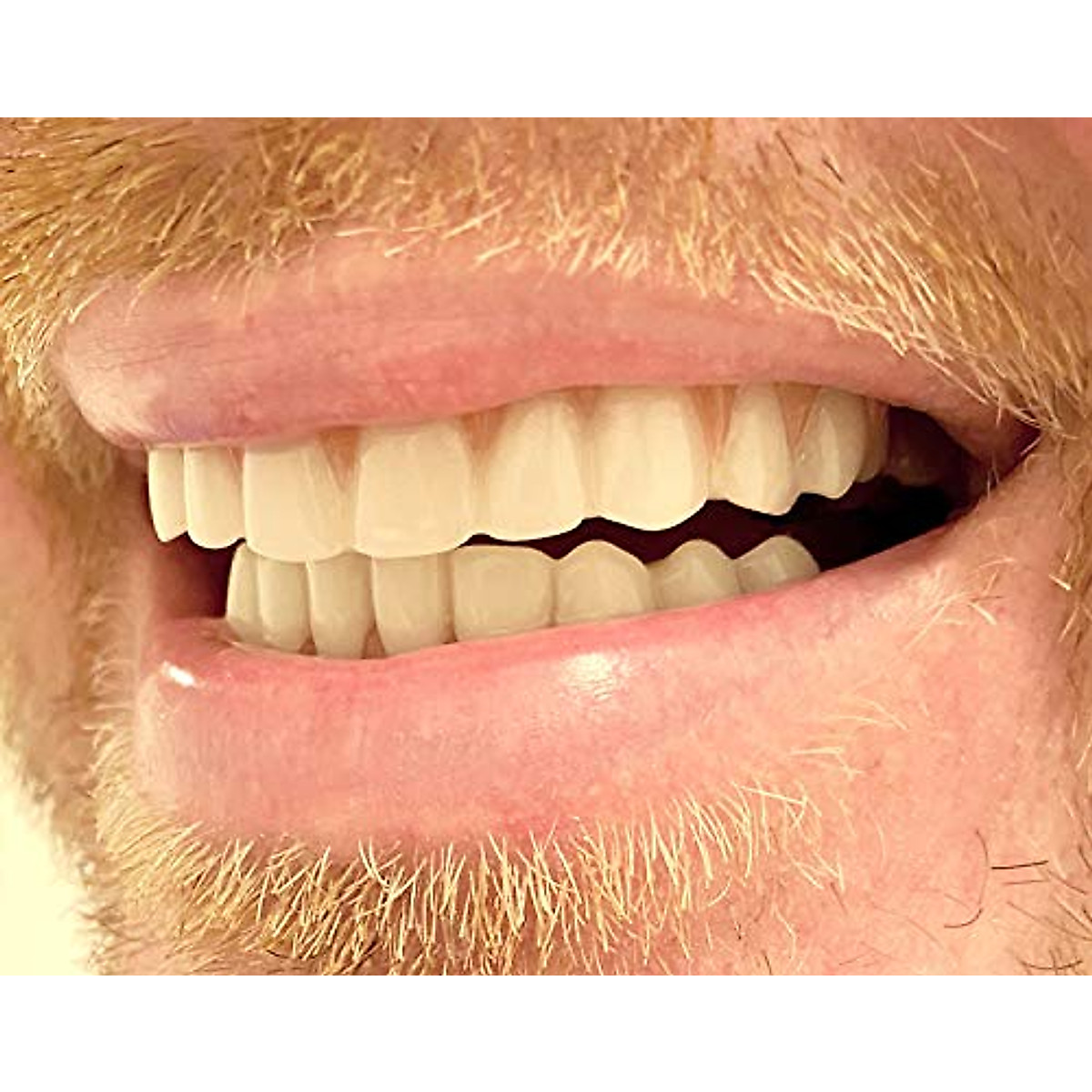 Instant Smile Comfort Fit Flex Teeth - Natural Shade Upper and Lower Kit with Vented Cleaning Case