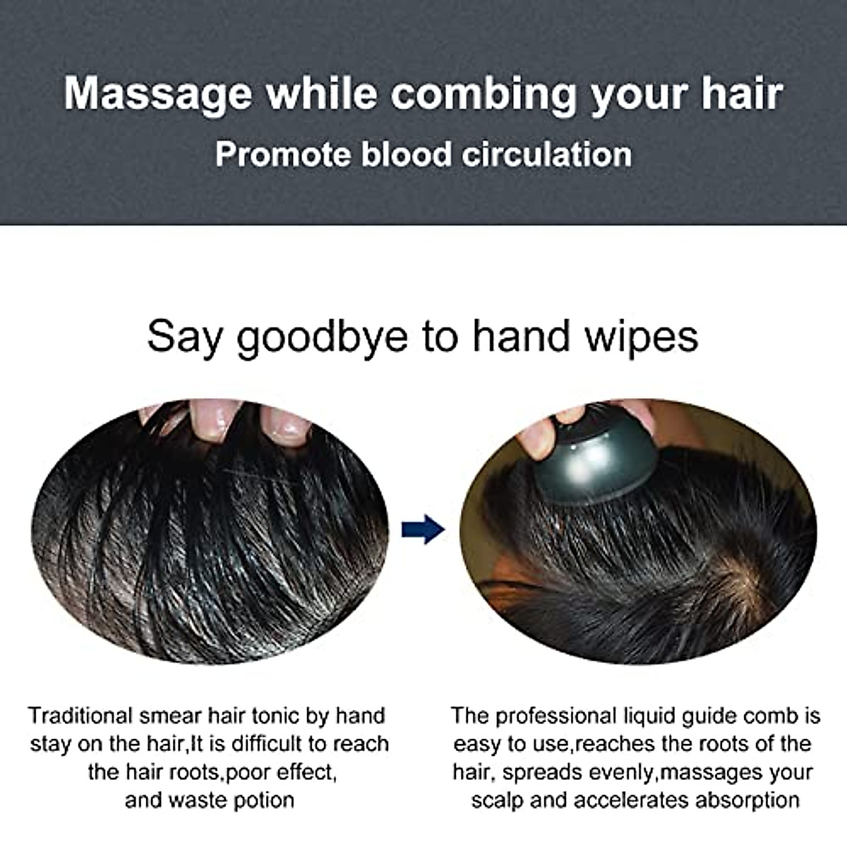 mriya Scalp Applicator Comb, Hair Oil Applicator for Medicine Scalp Head Fluid Comb Essential Oil Hair Treatment Head Scalp Massager Brush Hair Growth