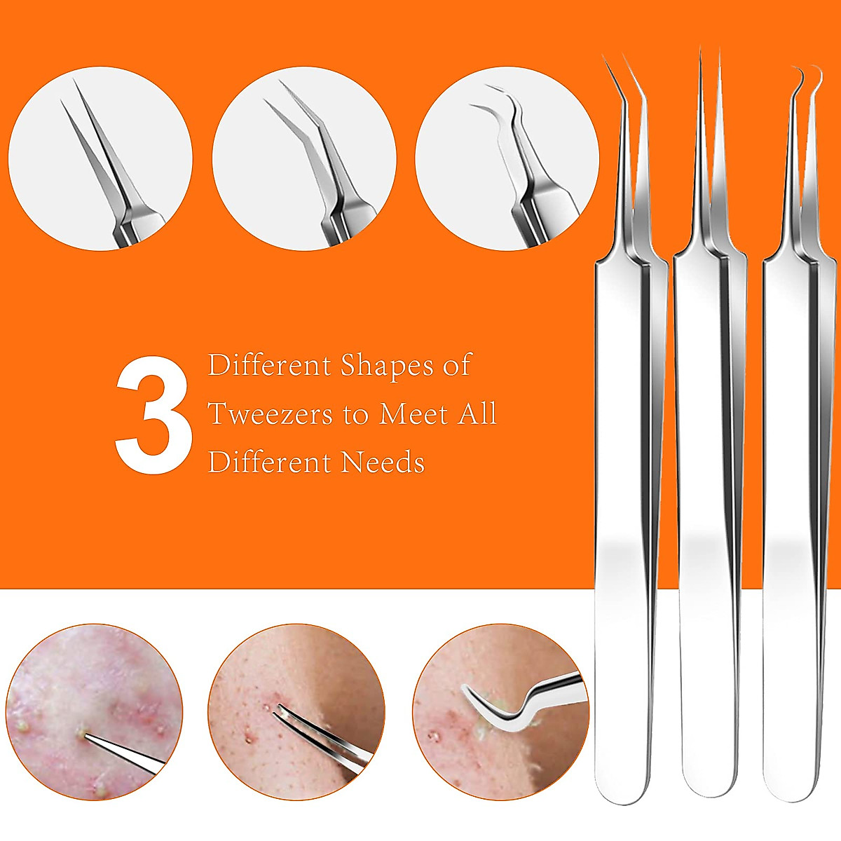 Pimple Popper Tool Kit, 15 PCS Blackhead Remover Comedone Acne Extractor Tools, Professional Sharp Stainless Skin Blemish Removal Pimple Tools with Metal Case