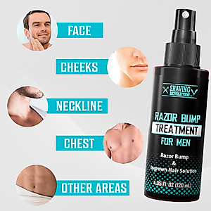 Viking Revolution Razor Bumps Treatment for Men Ingrown Hair Removal - After Shave for Men Ingrown Hair Serum - Salicylic Acid Bump Stopper Ingrown Hair Treatment for Men Razor Burn Treatment for Men