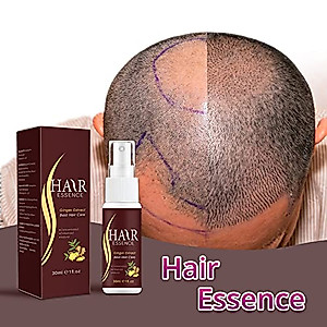 Korean Face Roller Hair Spray Hair Growth Oil Hair Growth Thicker Fuller Healthier Hair Hair Loss And Thinning Women And Men 30ml for Skin Care
