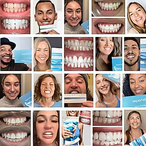 Expertwhite Teeth Whitening Gel Refills (6-gels). Made USA. 44 percent Carbamide Peroxide Tooth Bleaching Gel bleach For Invisalign style trays, Dental Grade Tooth Whitener. 6 syringes
