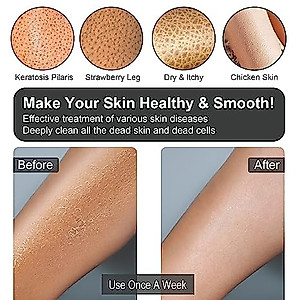 Exfoliating Gloves, Exfoliating Body Scrubber for Bath Shower Exfoliation, Body Scrub Exfoliator Loofah Sponge for Dead Skin Remover, Deep Korean Exfoliating Mitt