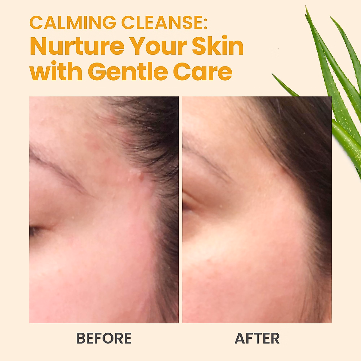 Face and Body Wash for Women and Men - Acne Body Wash Moisturizing for Sensitive Skin - Hydrating Facial Cleanser - Gentle Exfoliating Wash - with Manuka Honey (16oz)