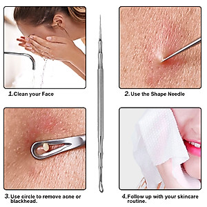 Pointed Blackhead Removal, 2-in-1 Acne Extractor Tool - Stainless Steel Whitehead Remover for Face/Nose
