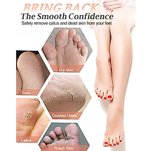 Maryton Natural Pumice Stone for Feet - Lava Foot Exfoliator Scrubber Pedicure Tools, Dead Skin Corn Callus Remover for Feet and Hands, 2 Count