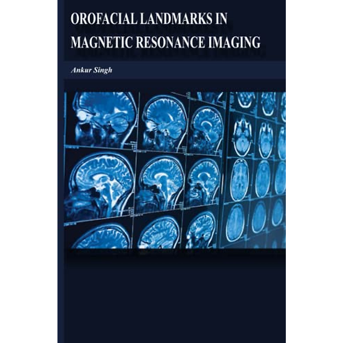 Orofacial Landmarks in Magnetic Resonance Imaging
