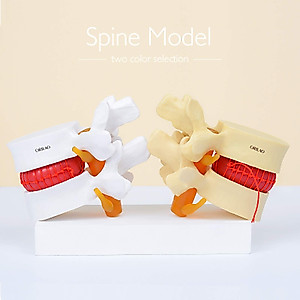 Human 1:1.5 Anatomical Lumbar Vertebral Spine Model,Vertebral Spine Anatomical for Study Eucation White Color