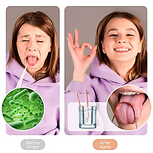 JUIDINTO Tongue Scraper 2 Pack, 100% Stainless Steel Tongue Scraper for Adults, Easy to Use Tongue Scraper with Case, Cleaning Tongue and Reducing Bad Breath for Oral Care