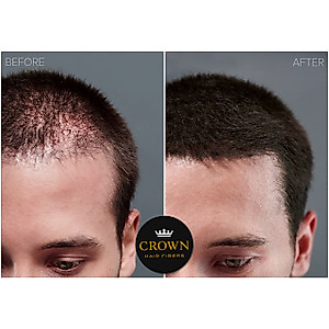 CROWN Hair Building Fibers (28g) - Instantly Cover Fine & Thinning Hair for a Thicker, Fuller Look - A Natural Keratin Concealer - 13 Shades for Men & Women - Black