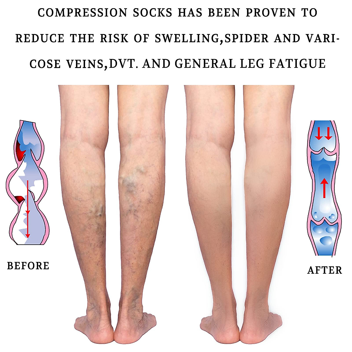 LIN PERFORMANCE Calf Compression Sleeves for Men and Women 20-30mmhg Calf Support Sleeves Footless Lightweight for Running Cycling Travel Circulation Recovery Pain Relief(Blue,M)