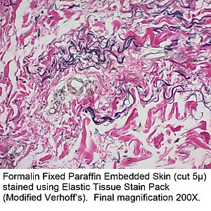 Elastic Tissue Stain Pack (Modified Verhoff's), 125ml