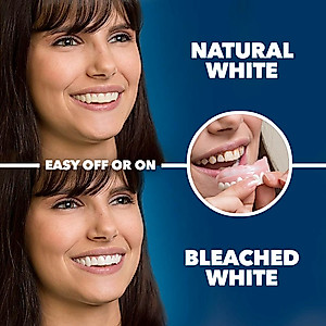 Imako Premium Cosmetic Teeth - 1 Pack - Large, Natural White - Upper Veneers - Custom Fit at Home, DIY Smile Makeover - Made in USA