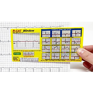 R-CAT EKG Window 2nd Edition