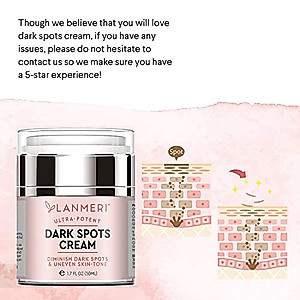 Lanmeri Dark Spot Remover for Face and Body, Dark Spot Corrector Fade Cream, Age Spot, Brown Spot, Sun Spot & Freckle Remover for Face, Hands and Other Body Areas, for Both Women and Men, for All Skin Types