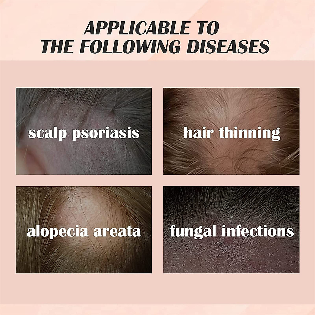 CPO Fᴏlliᴄle Nᴏᴜrishing Hairgrᴏᴡth Serᴜm, Hair Revival Serum,Hair Loss & Hair Thinning Serum for Hair Loss and Dry Damaged,Hair Regrowth Essence for Women Men-30ml (2PCS)