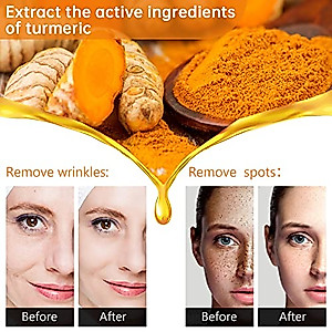 Turmeric Serum for Dark Spots Remover, Turmeric Dark Spot Corrector Serum for Face & Body, Anti Aging Facial Serum for Women and Men, Skin Care Moisturizing Repair Serum, Improve Skin Tone (1Fl Oz)